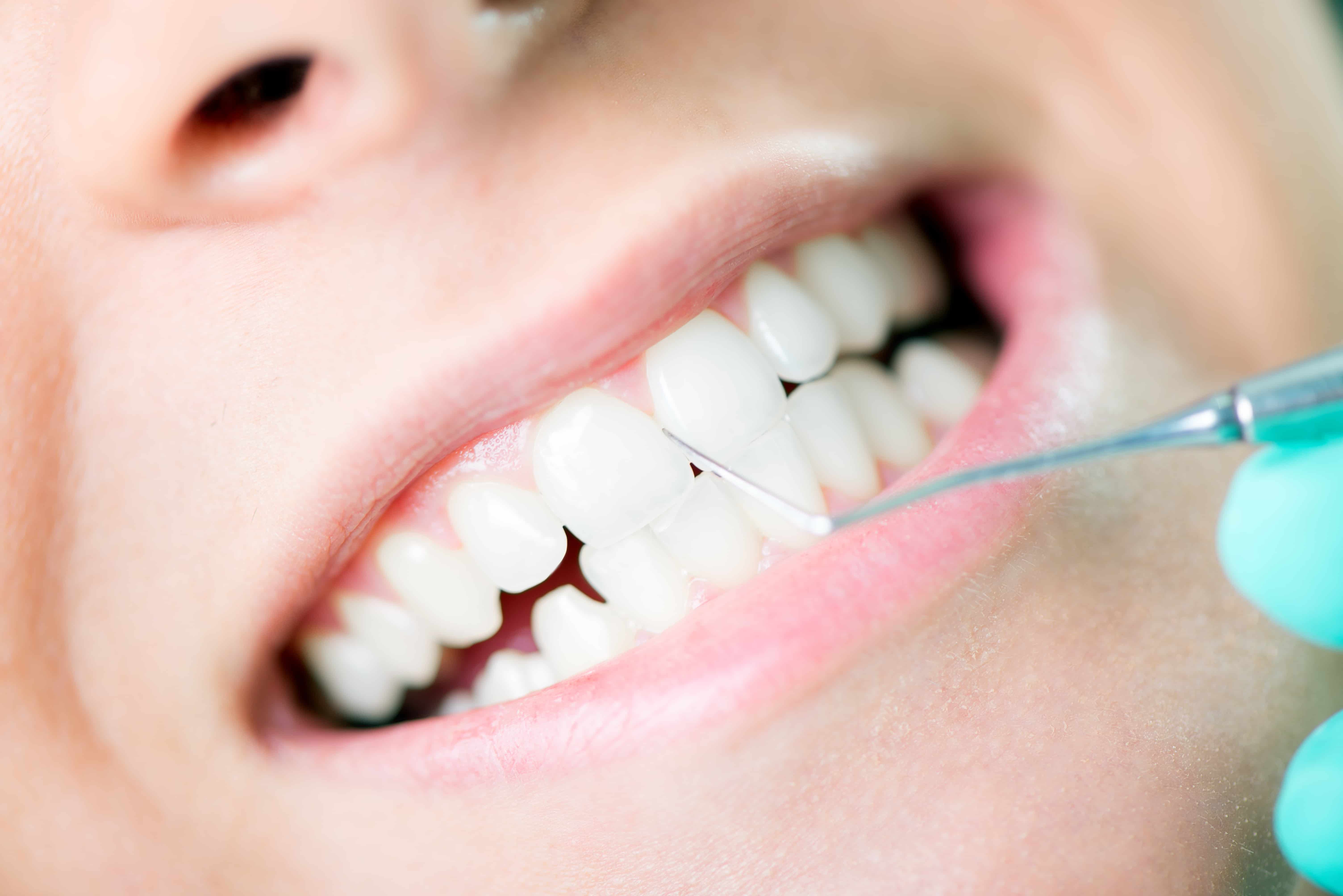 El Paso Dentists Explain How A Cleaning Prevents Gum Disease | El Paso, TX